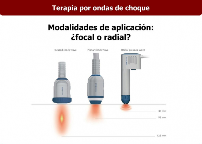 ¿Realmente me están aplicando Ondas de Choque? - Fisioterapia Sei Herri ...
